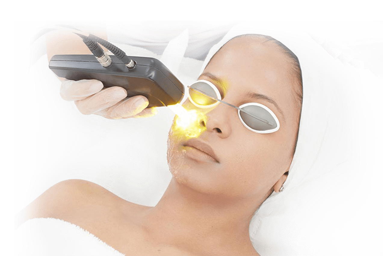 Dual Yellow Laser - Bondi Junction Cosmetic Clinic